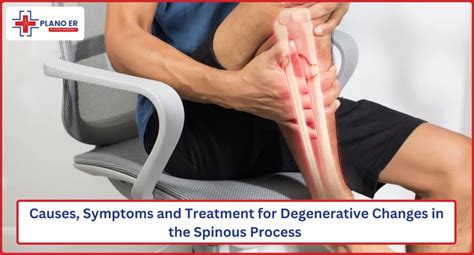 What Is Spinous Process Function Location And Injury Care
