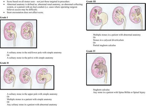 References In The Guys Stone Score—grading The Complexity Of Percutaneous Nephrolithotomy