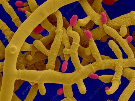 Trichoderma Citrinoviride Endophytic Fungus Sem Stock Image C032 2984 Science Photo Library