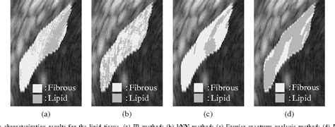 Figure 16 From An Intravascular Ultrasound Based Tissue