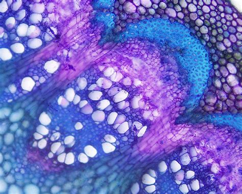 Secondary Xylem