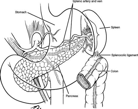 Splenectomy Open Clinical Tree