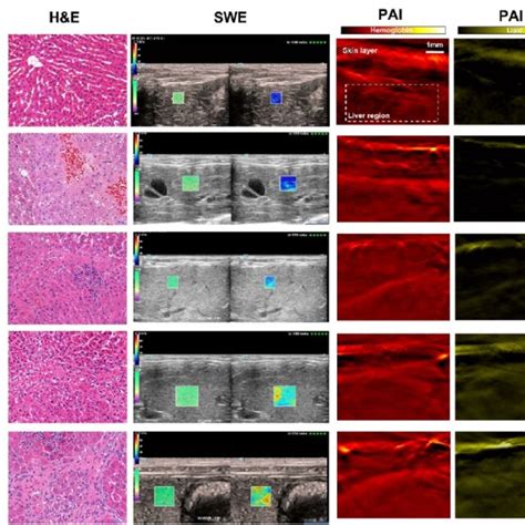 First Column Masson Dye Second Column Hande Dye Third Column Liver Download Scientific