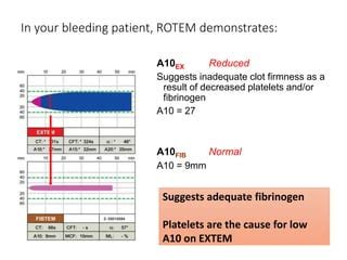 ROTEM An Introduction And Overview Pptx
