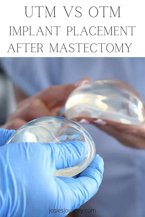 Learn About The Difference Between Utm And Otm Placement For Breast