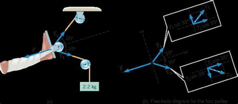 Illustrating The Forces Acting On An Accelerating Car With A Free Body