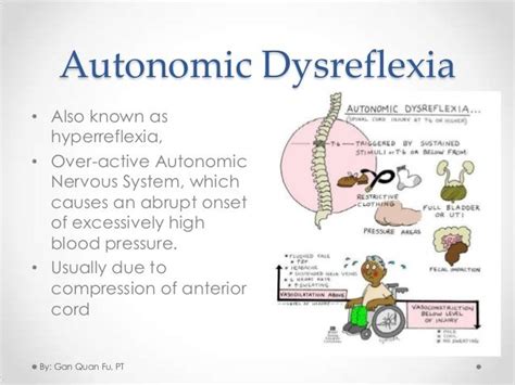 Autonomic Dysreflexia Nursing School Survival Emergency Nursing