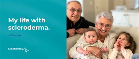 Scleroderma Autoimmune Disease Research Chair Funding Scleroderma Bc