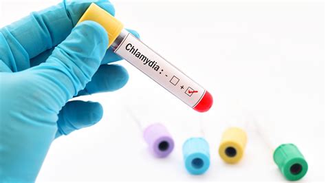 Chlamydia Trachomatis Antikoru Igg Testi Fiyatı Nasıl Ve Nerede Yapılır