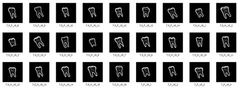 Result Of Sobel Algorithm Download Scientific Diagram