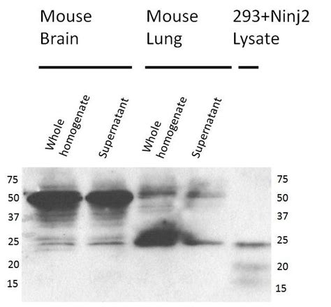 6 Detection Of Mouse Brain And Lung Proteins With A Molecular Size Of