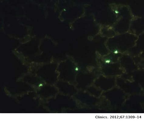 Comparison Of Celsior And Perfadex Lung Preservation Solutions In Rat