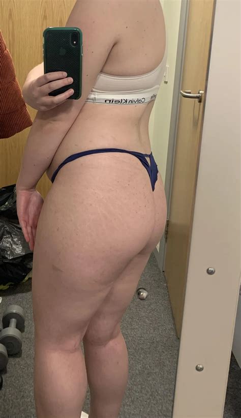 Normalise Stretch Marks And Imperfections 😌 Scrolller