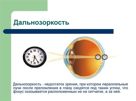 Дефекты зрения презентация онлайн