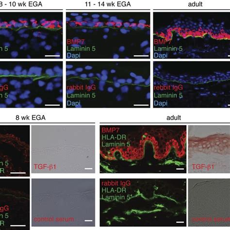 Gene Expression Analysis Clustering Using Complete Linkage Algorithm Download Scientific