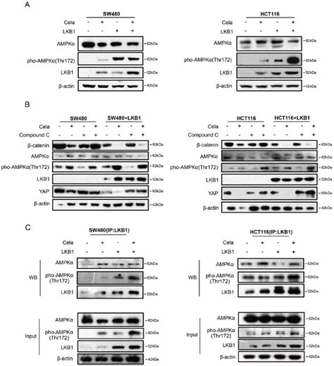 Celastrol induced β catenin degradation was partly mediated by Download Scientific Diagram