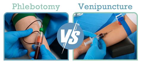Phlebotomy Vs Venipuncture Whats The Difference Medarchitect