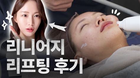 눈으로 확인 가능한 즉각 효과 최신상 착붙 리프팅 받고 왔어요💥 시술 Vlog Youtube