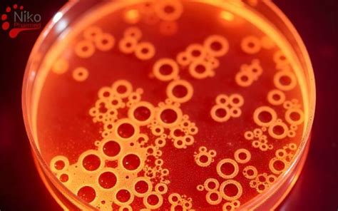 Disk Diffusion Testing Kirby Bauer Method