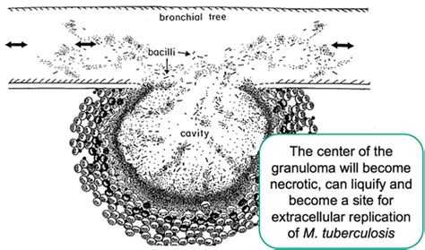 Microbiology Mycobacteria Flashcards Quizlet