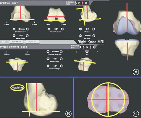 Adapted User Interface Showing The Data Necessary For Preoperative