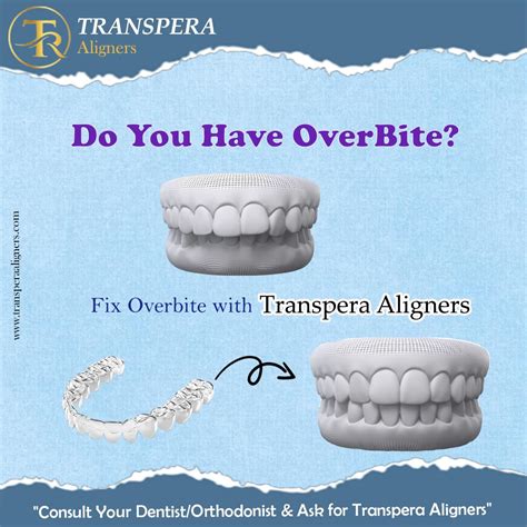 How Clear Aligners Can Fix Overbite Transpera Aligners Posted On The Topic Linkedin