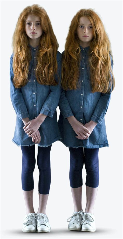 Enæggede Tvillinger Er Ikke Ens Illvid Dk