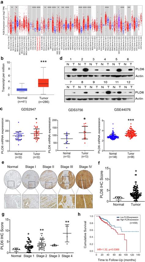 磷脂酶 D6 通过线粒体代谢重编程激活 Wnt β Catenin 信号传导，促进结直肠癌的肿瘤发生 Experimental And Molecular Medicine X Mol
