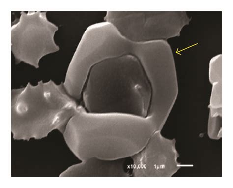 Scanning Electron Micrograph Of Dysmorphic Erythrocyte Induced By
