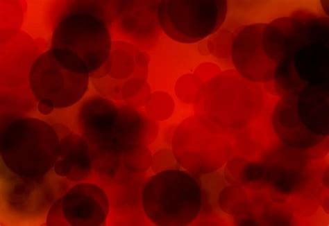 Медики назвали внешние признаки повышенного холестерина Facenews Ua новости Украины