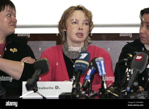 Isabelle Dinoire The French Woman Who Received The Worlds First