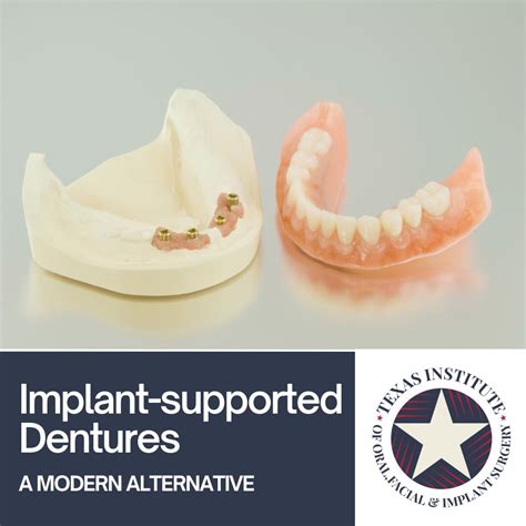 Implant Supported Dentures A Modern Alternative For Missing Teeth