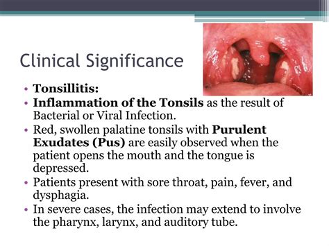 Histology Of Tonsil Pptx