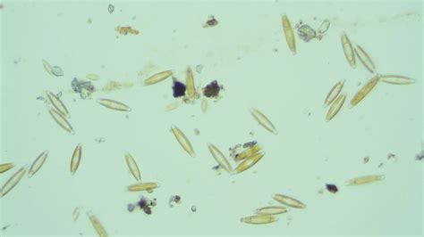 污水中的微生物 模板素材 稿定设计
