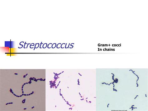 Ppt Streptococcus Powerpoint Presentation Free Download Id 2742719