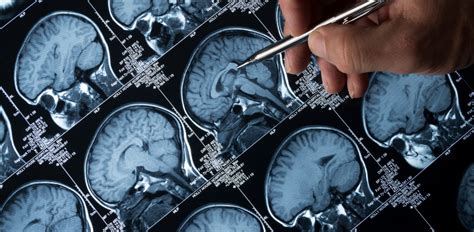 sex based differences in tic disorder diagnoses conexiant