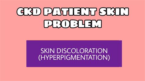 Ckd Patient Skin Problem Last Type Skin Discoloration Hyperpigmentation Youtube