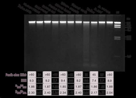 Monarch® Spin Gdna Extraction Kit Neb