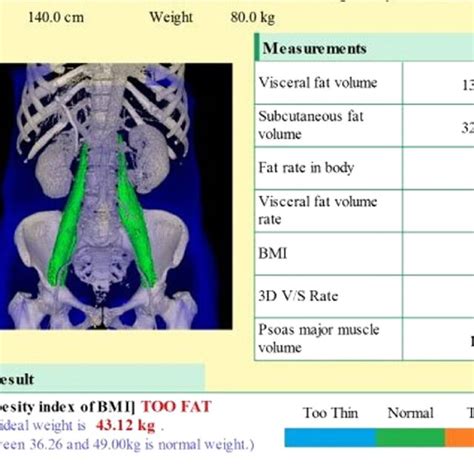 Visceral And Subcutaneous Fat Psoas Muscle Mass And Liver Volume