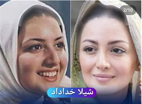 عکس‌های 8 خانم بازیگر ایرانی قبل و بعد از عمل