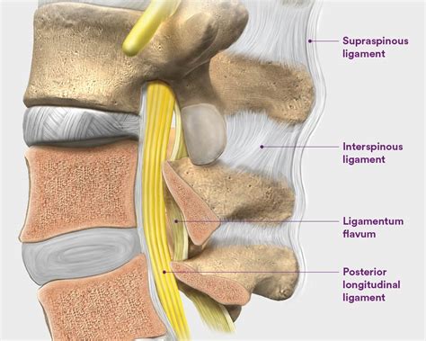 Interspinous Ligament Cadaver