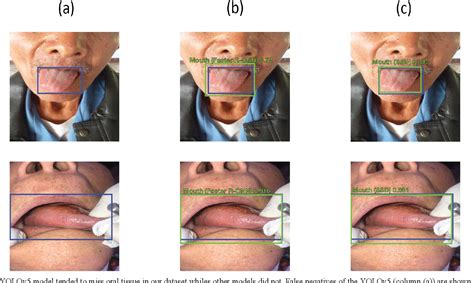 Figure 5 From Oral Tissue Detection In Photographic Images Using Deep Learning Technology