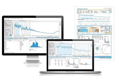 Top Features To Consider In Scientific Hrv Analysis Software