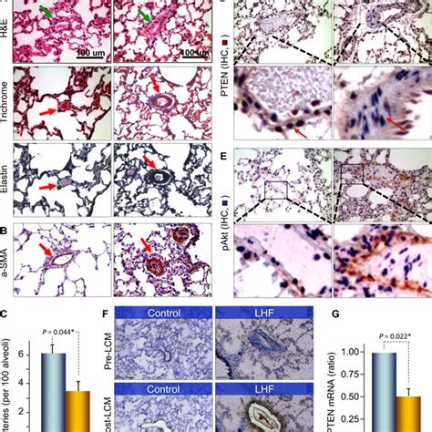 Pulmonary Vascular Remodeling And Loss Of Pten In Lhf Ph Download