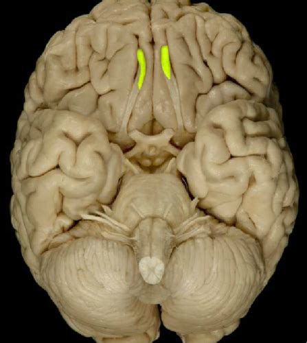 LAB Brain And Cranial Nerves Flashcards Quizlet