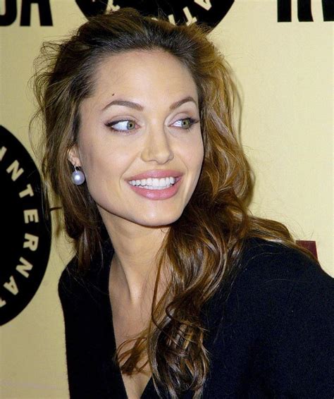 30+ Celebrities with Veneers | Antlara Dental