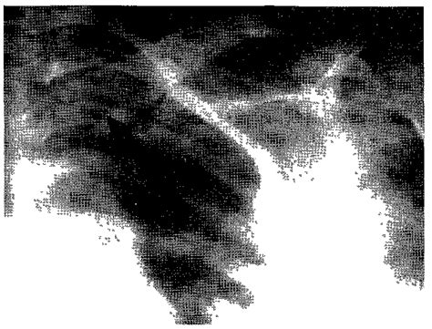 Chest Radiograph Pa View Showmg Normal Lung Fields This Is An