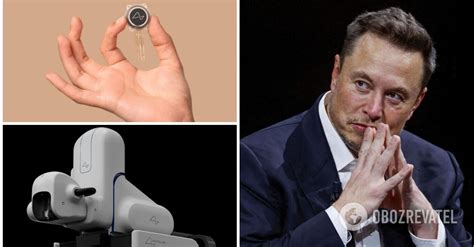 Neuralink Chip Implanted In Human Brain For The First Time What It Looks Like Research Photo