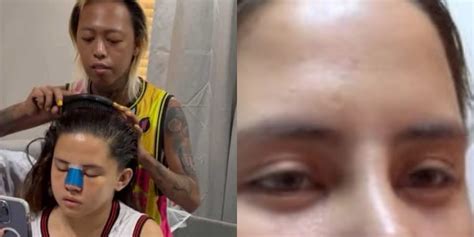 Antonette Gail Ipinakita Ang Naging Resulta Ng Pagpapagawa Ng Kanyang