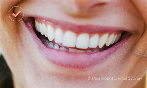 Dental Implants Sydney Replace Missing Teeth Paramount Dental